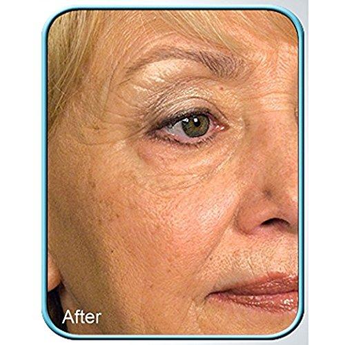 Biologic Stem Cell Wrinkle Therapy - (Set of 2 BioLogic